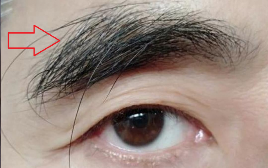 Lông mày của nam giới mọc dài hơn sau tuổi 60: Là phúc lộc hay vấn sức ...
