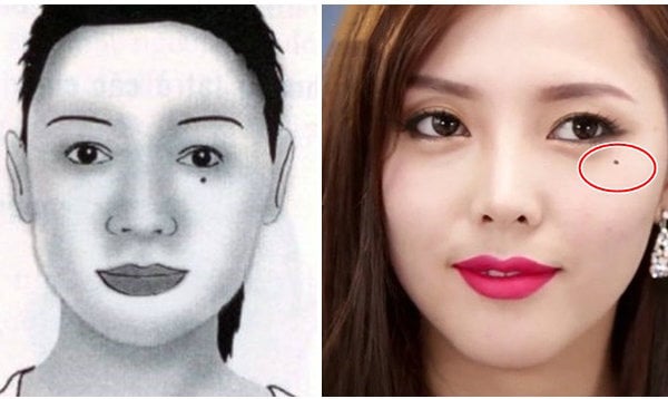 7 nốt ruồi độc mang đến toàn vận xui, giữ lại thì cả đời nghèo hèn, xoá ...