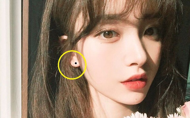 3 Nốt Ruồi Cực Phẩm Tượng Trưng Cho Tài Lộc Phát Chỉ 13 Phúc Lộc Sâu Dày Cả đời Giàu Sang