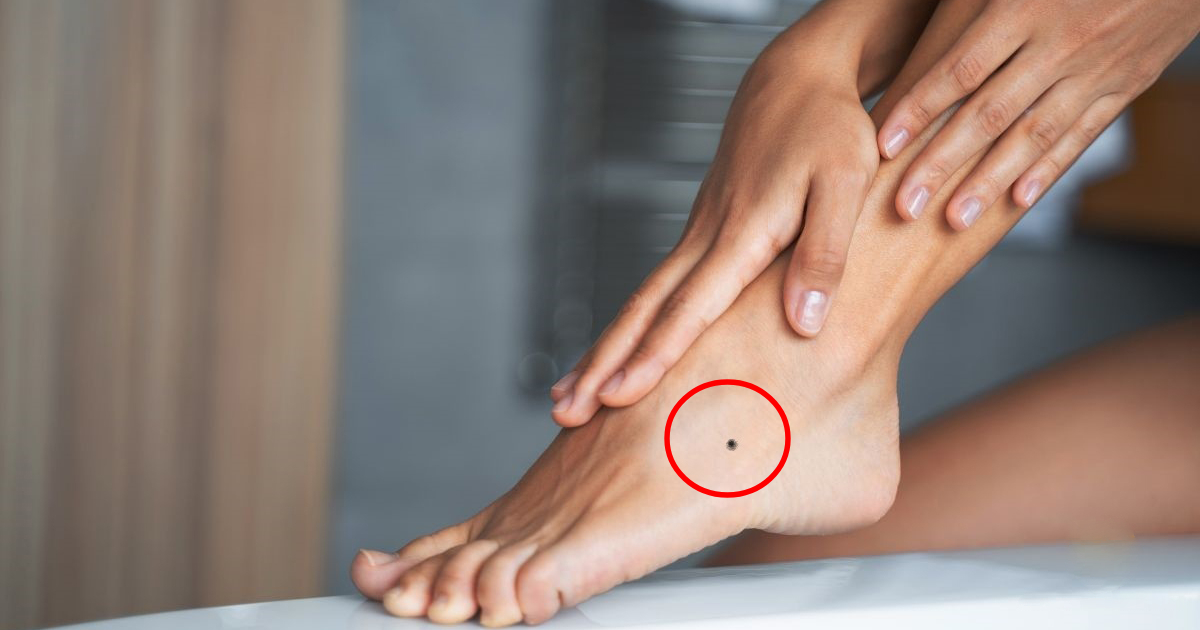 5 Nốt Ruồi Tượng Trưng Cho Tài Lộc Phú Quý Có 15 May Mắn đủ đường Cả đời Giàu Sang