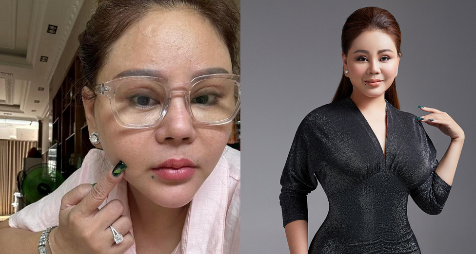 Lê Giang lên tiếng khi bị nghi tiêm filler đến mức 'méo mặt', tiết lộ ...