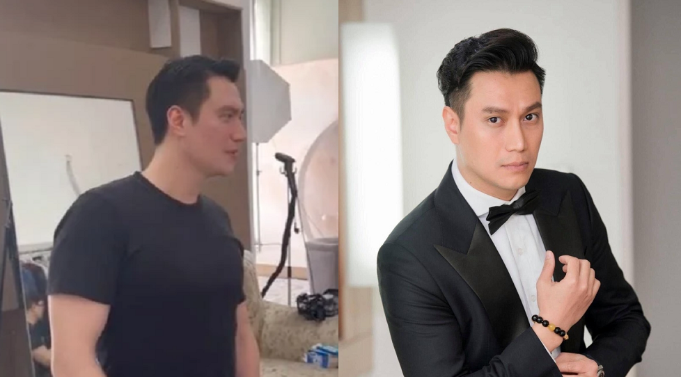 Diện mạo Việt Anh hiện tại ra sao sau 4 năm sang Hàn phẫu thuật thẩm mỹ?