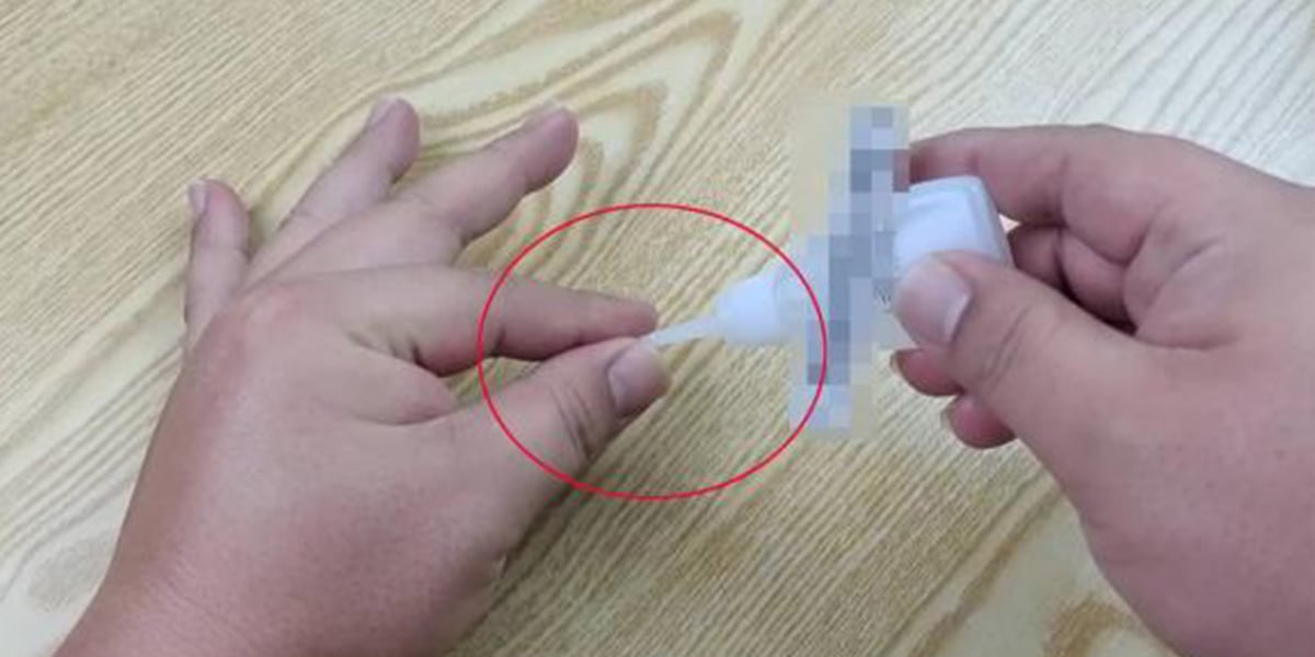 Tay Bị Dính Keo 502 Cứ Nhỏ Thêm Giọt Này Là Keo Tan Chảy Ngay Không