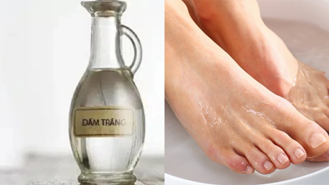 Cách khử mùi hôi chân hiệu quả với giấm trắng và rượu trắng