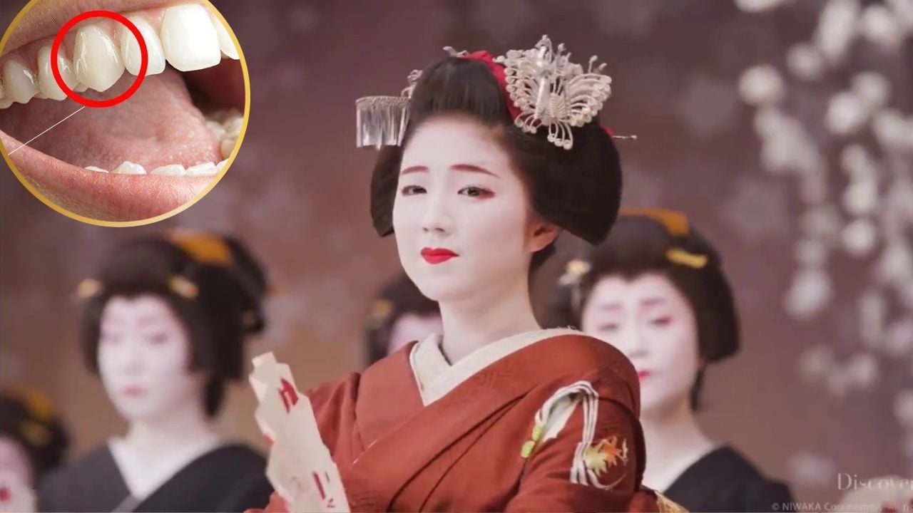 Tại sao 90% người Nhật đều có hàm răng không đều?